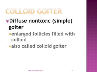 Thyroid - Goiter | PPTX