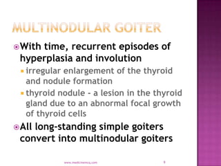Thyroid - Goiter | PPTX