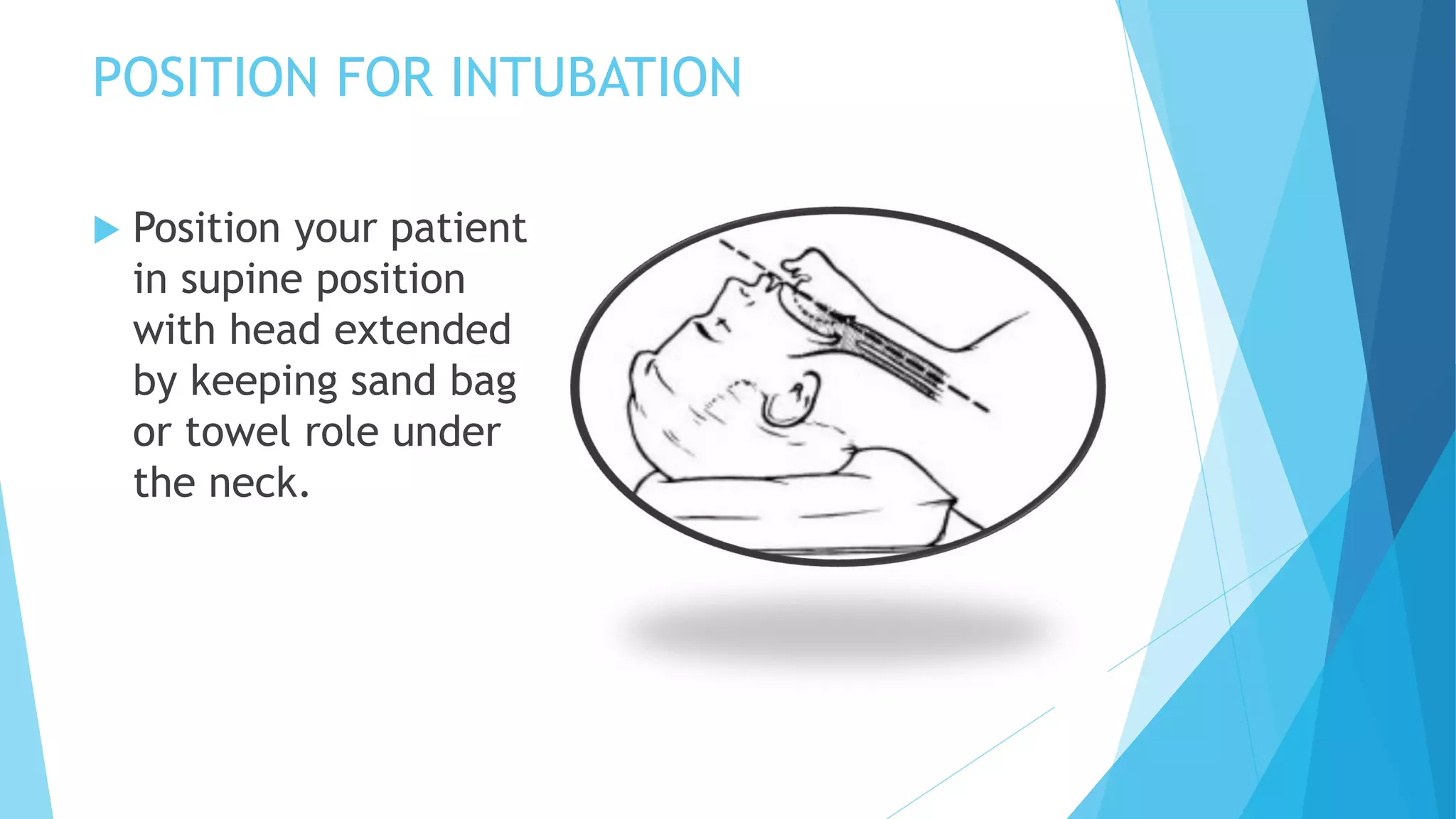 Endotracheal intubation | PDF