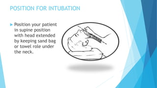 Endotracheal intubation | PDF