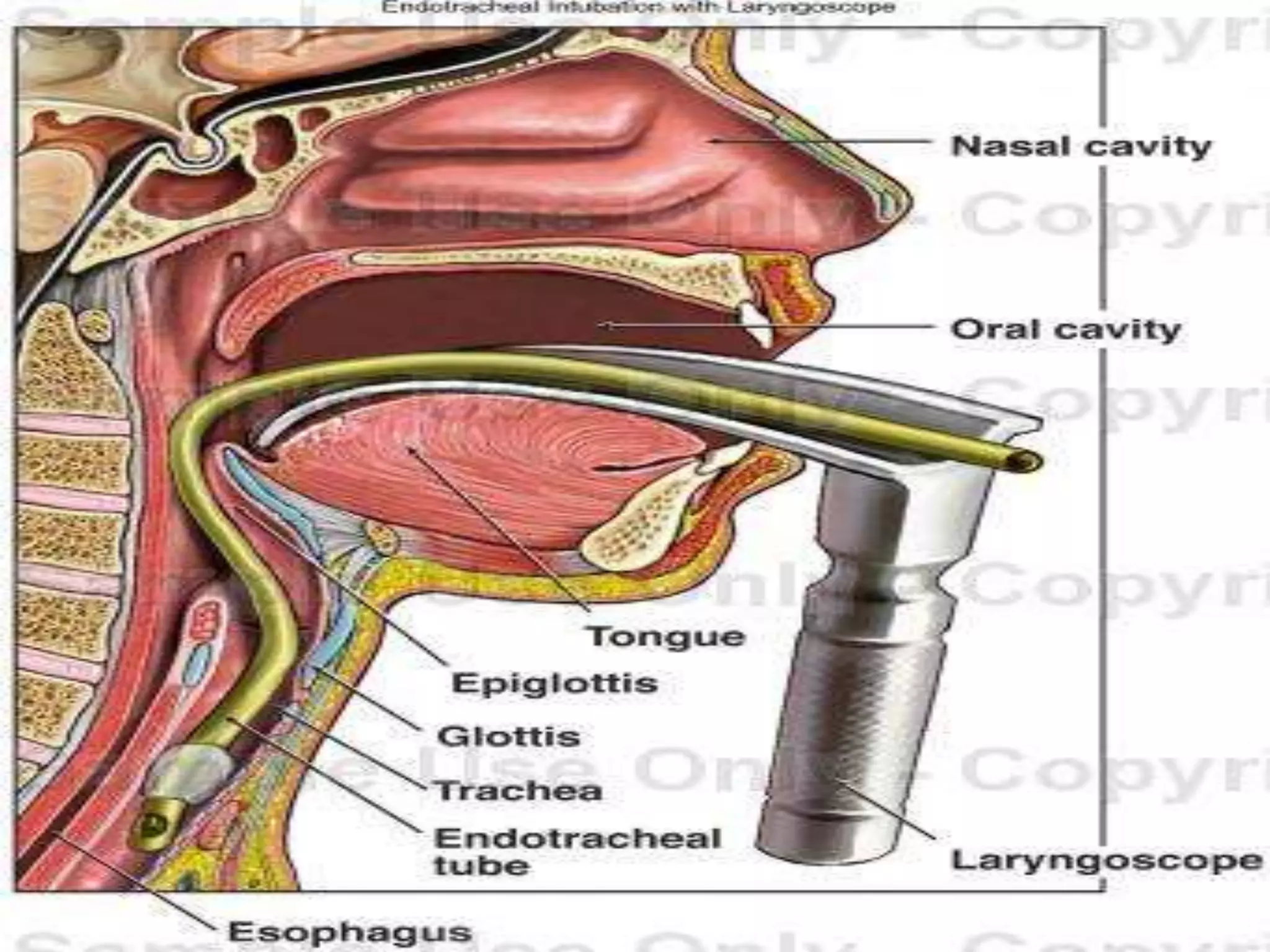 Endotracheal intubation | PPTX