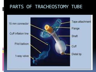 Endotracheal intubation | PPT