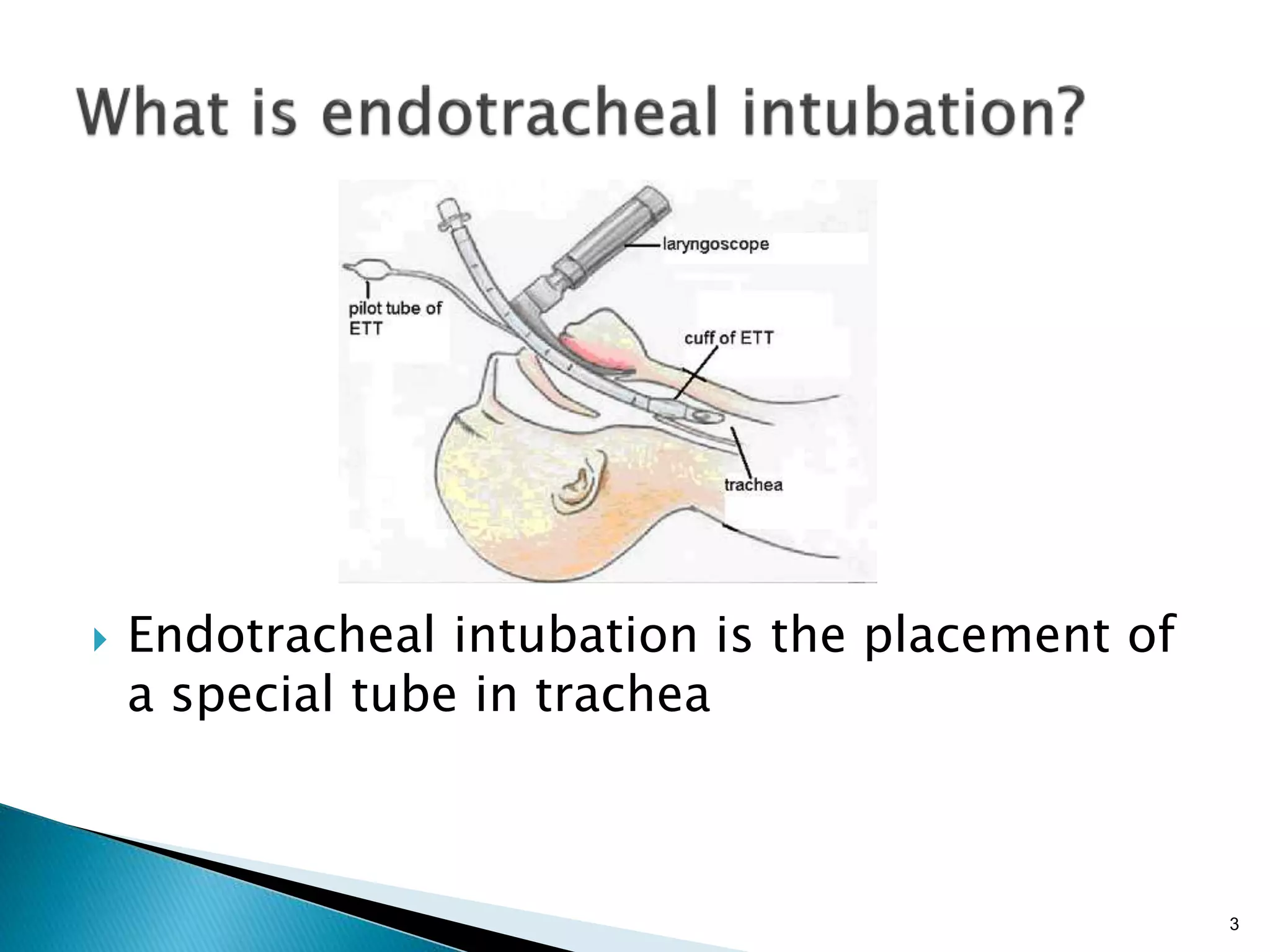 Endotracheal intubation | PPTX