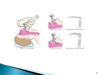 Endotracheal intubation | PPTX