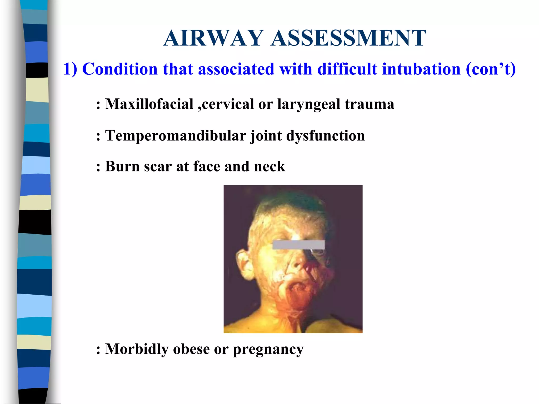 Endotracheal Intubation | PPTX