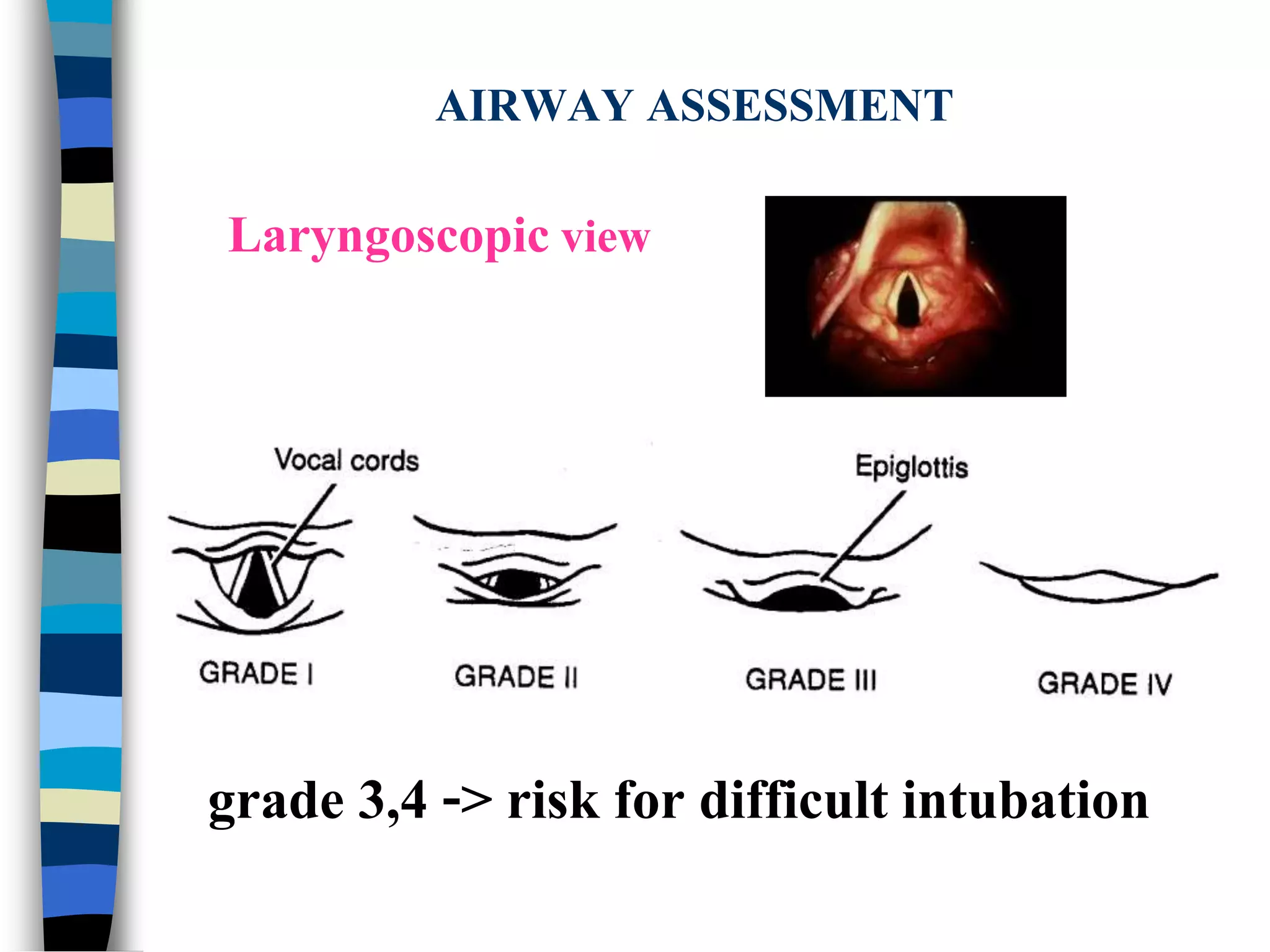 Endotracheal Intubation | PPTX