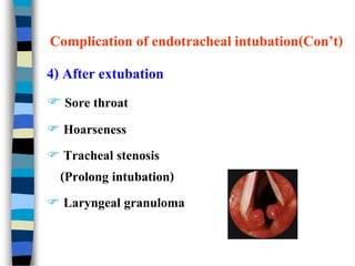 Prolonged Intubation Complications