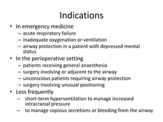 Endotracheal intubation | PPTX | Ear, Nose and Throat Conditions ...