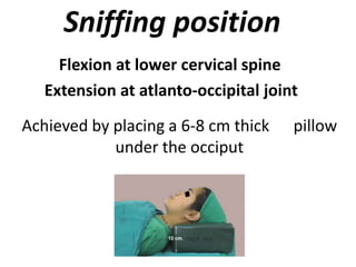 Endotracheal intubation | PPTX | Ear, Nose and Throat Conditions ...