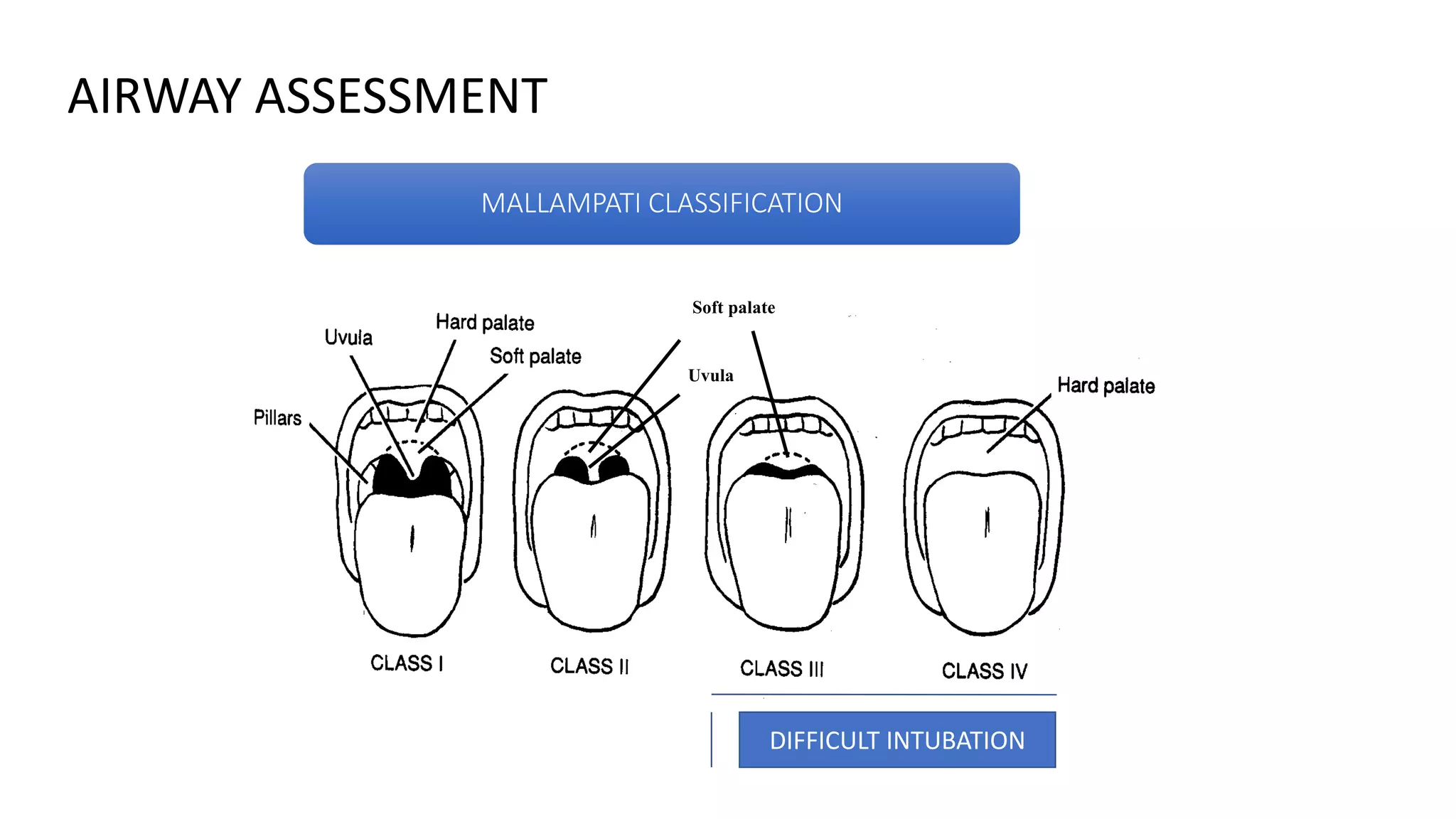 Endotracheal intubation | PPTX | Ear, Nose and Throat Conditions ...