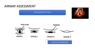 Endotracheal intubation | PPTX