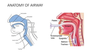 Endotracheal intubation | PPTX