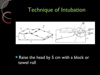 Endotracheal intubation | PPT