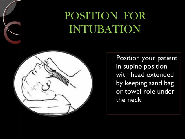 Endotracheal intubation | PPT