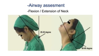 Endotracheal intubation | PPTX