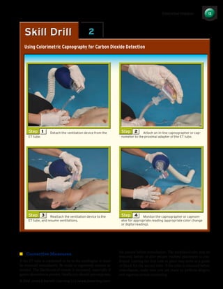 Endotracheal intubation | PDF