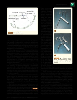 Endotracheal intubation | PDF