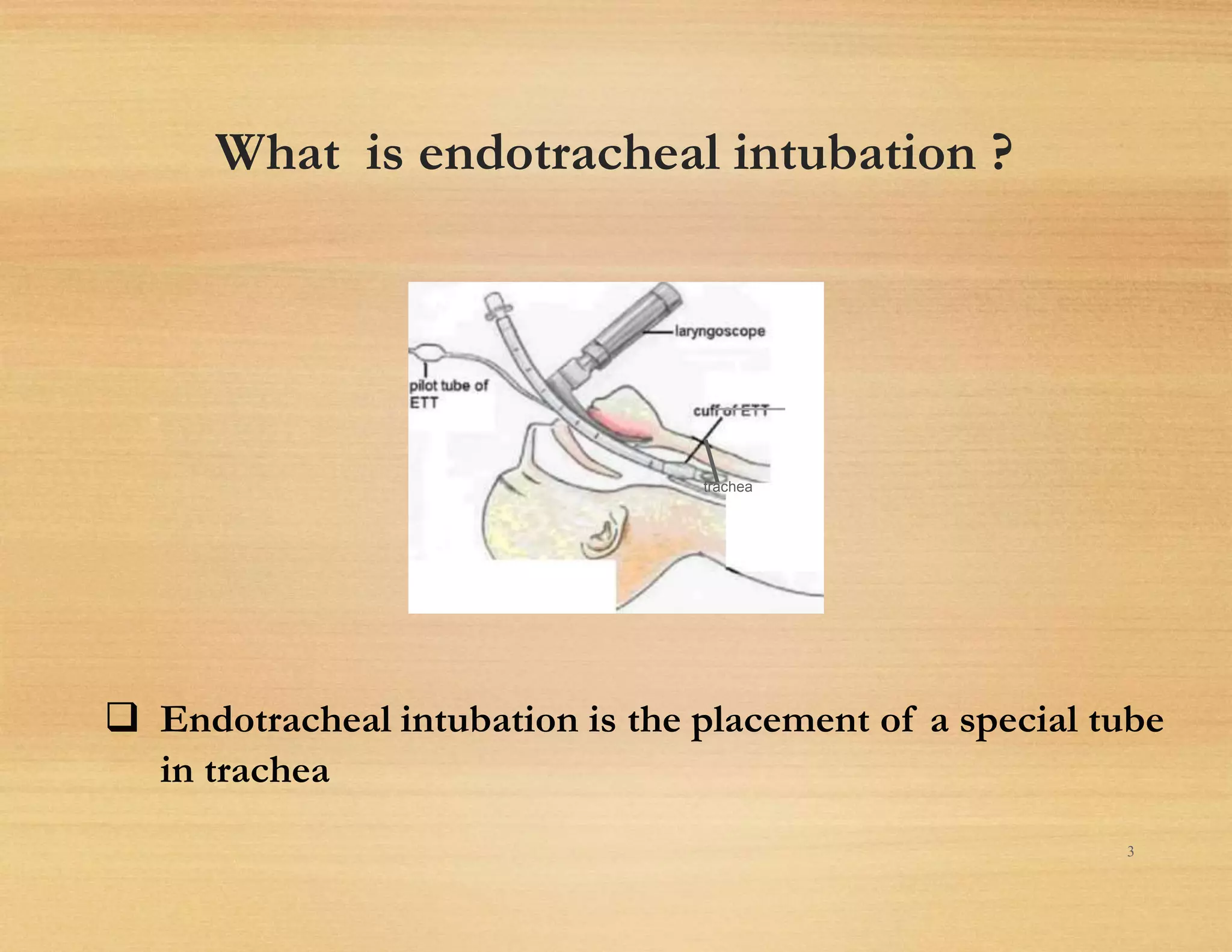Endotracheal Intubation.pptx