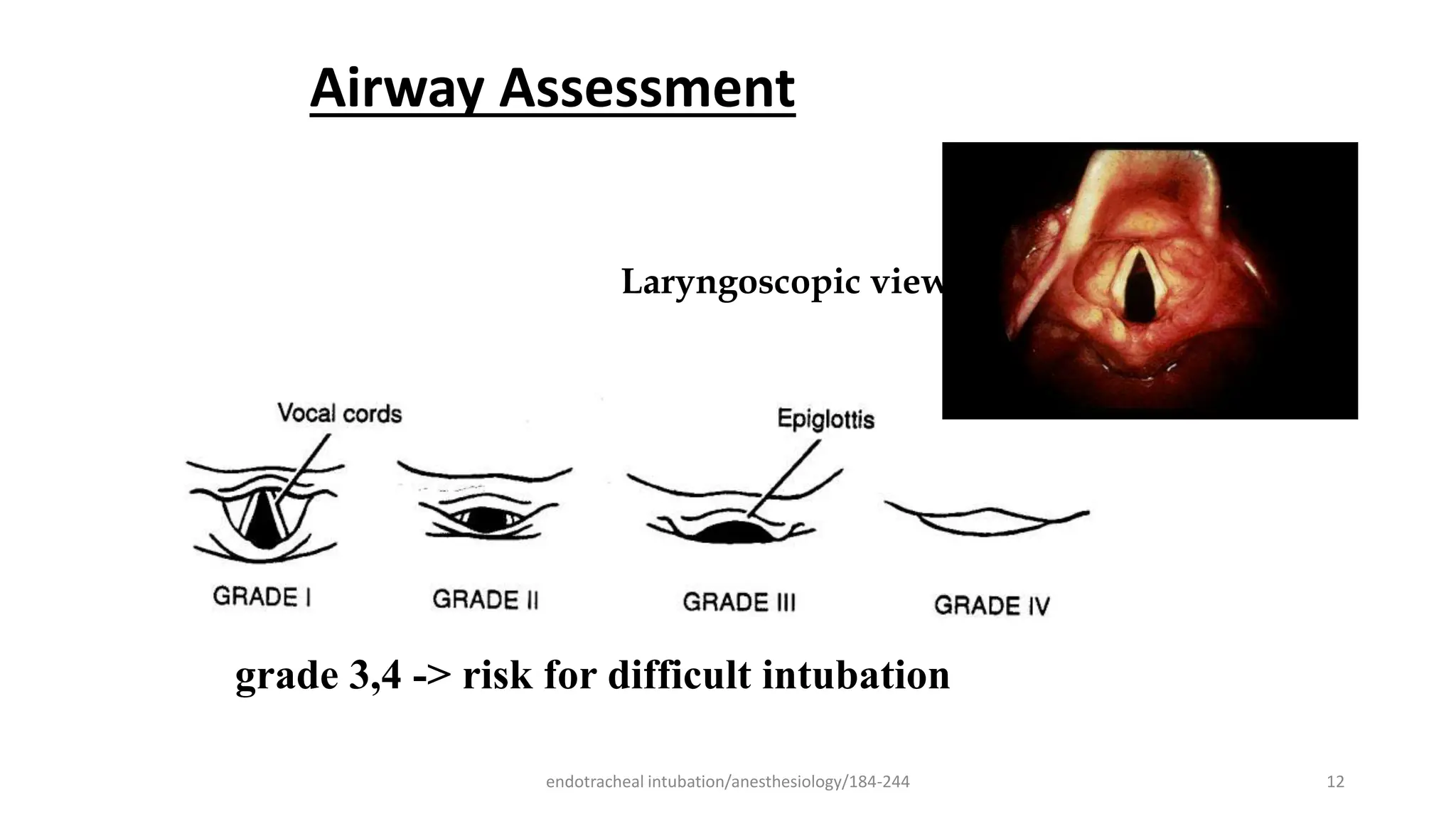 ENDOTRACHEAL INTUBATION PowerPoint.pptx