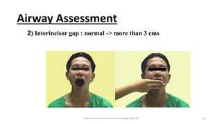 ENDOTRACHEAL INTUBATION PowerPoint.pptx