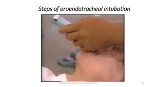 ENDOTRACHEAL INTUBATION PowerPoint.pptx