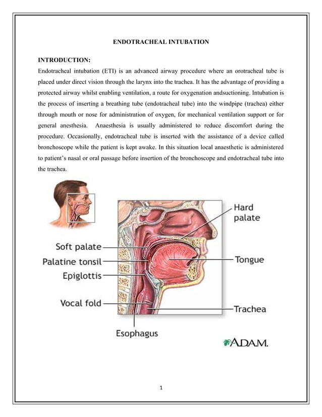 ENDOTRACHEAL INTUBATION ,INDICATION, PROCEDURE | DOCX