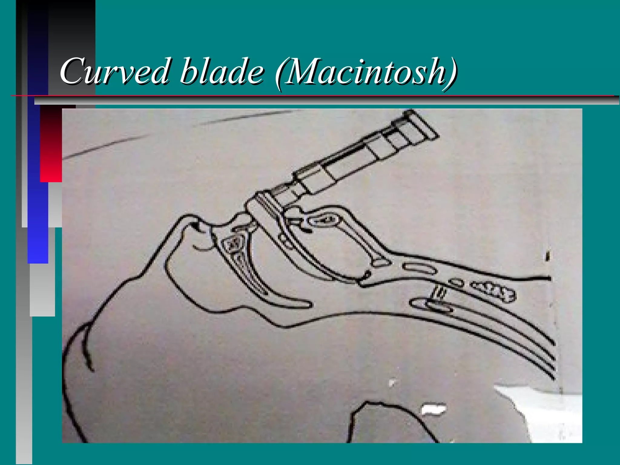 Endotracheal intubation extubation | PPT