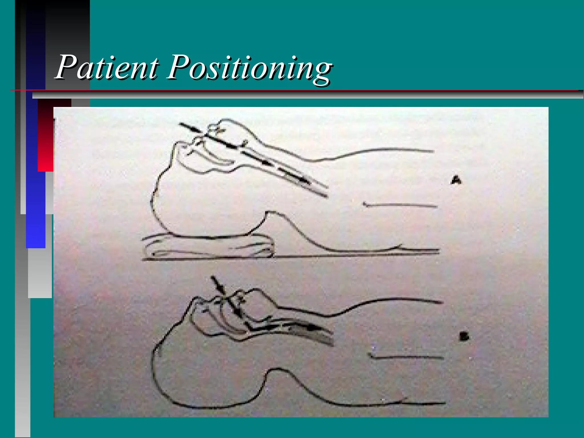 Endotracheal intubation extubation | PPT