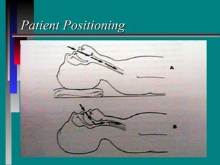 Endotracheal intubation extubation | PPT