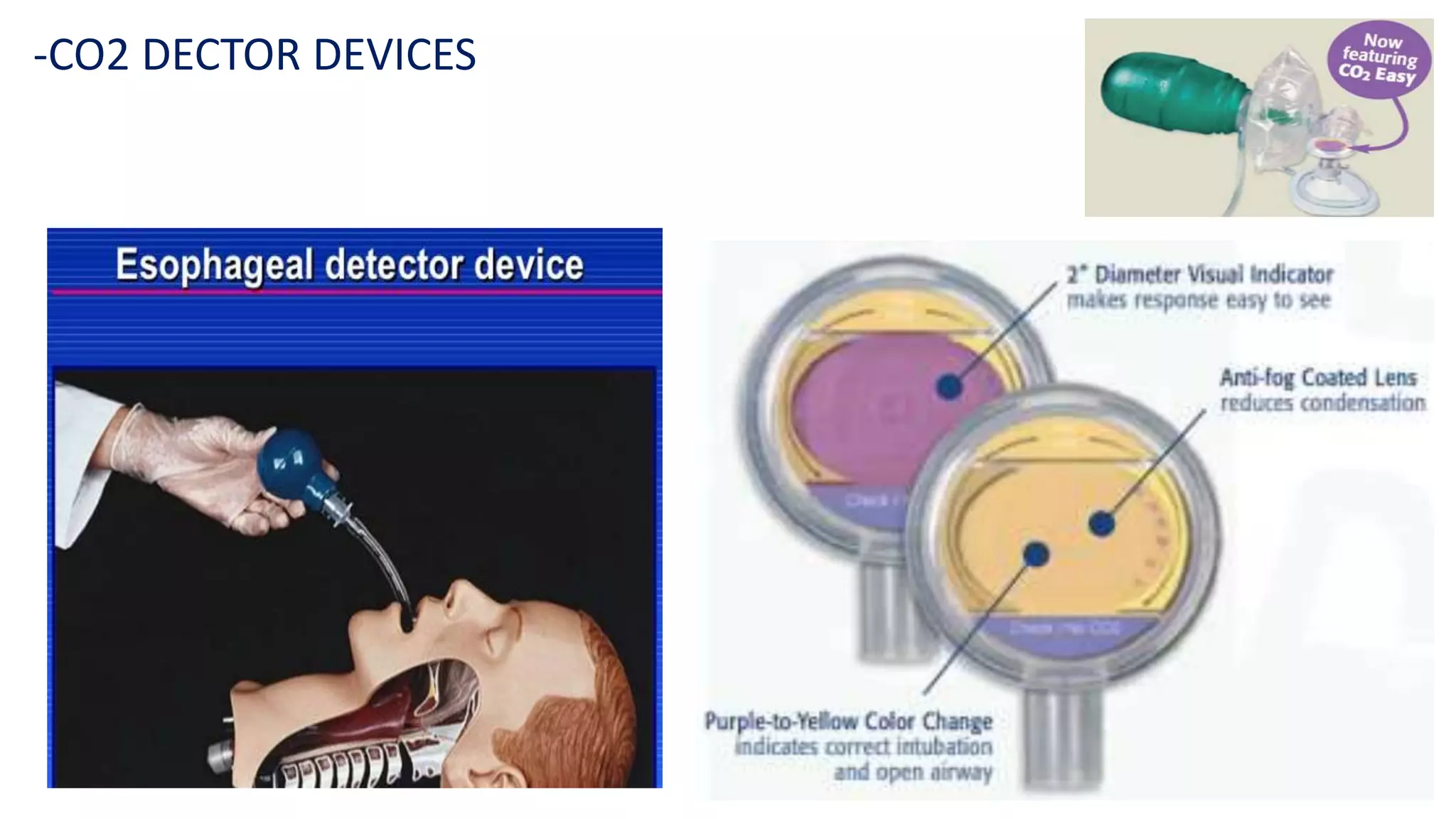Endotracheal intubation and laryngoscopy part 2 | PPTX