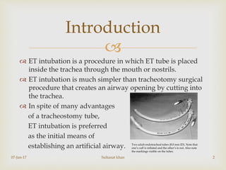 Endotracheal intubation, indications, complications. | PPTX