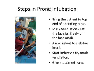 Endotracheal Intubation in Prone Position.pptx