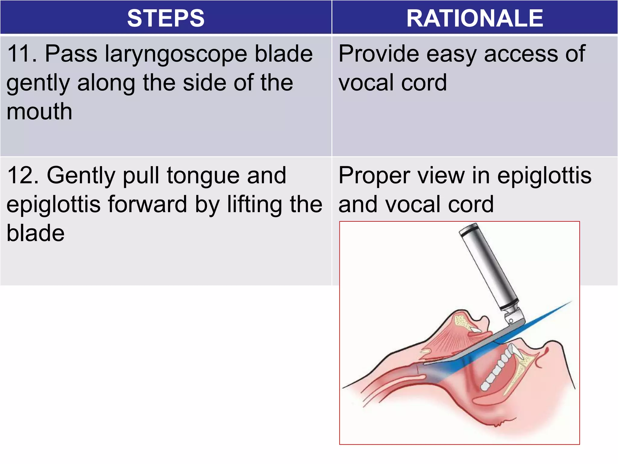 Endotracheal intubation nursing procedure | PPTX
