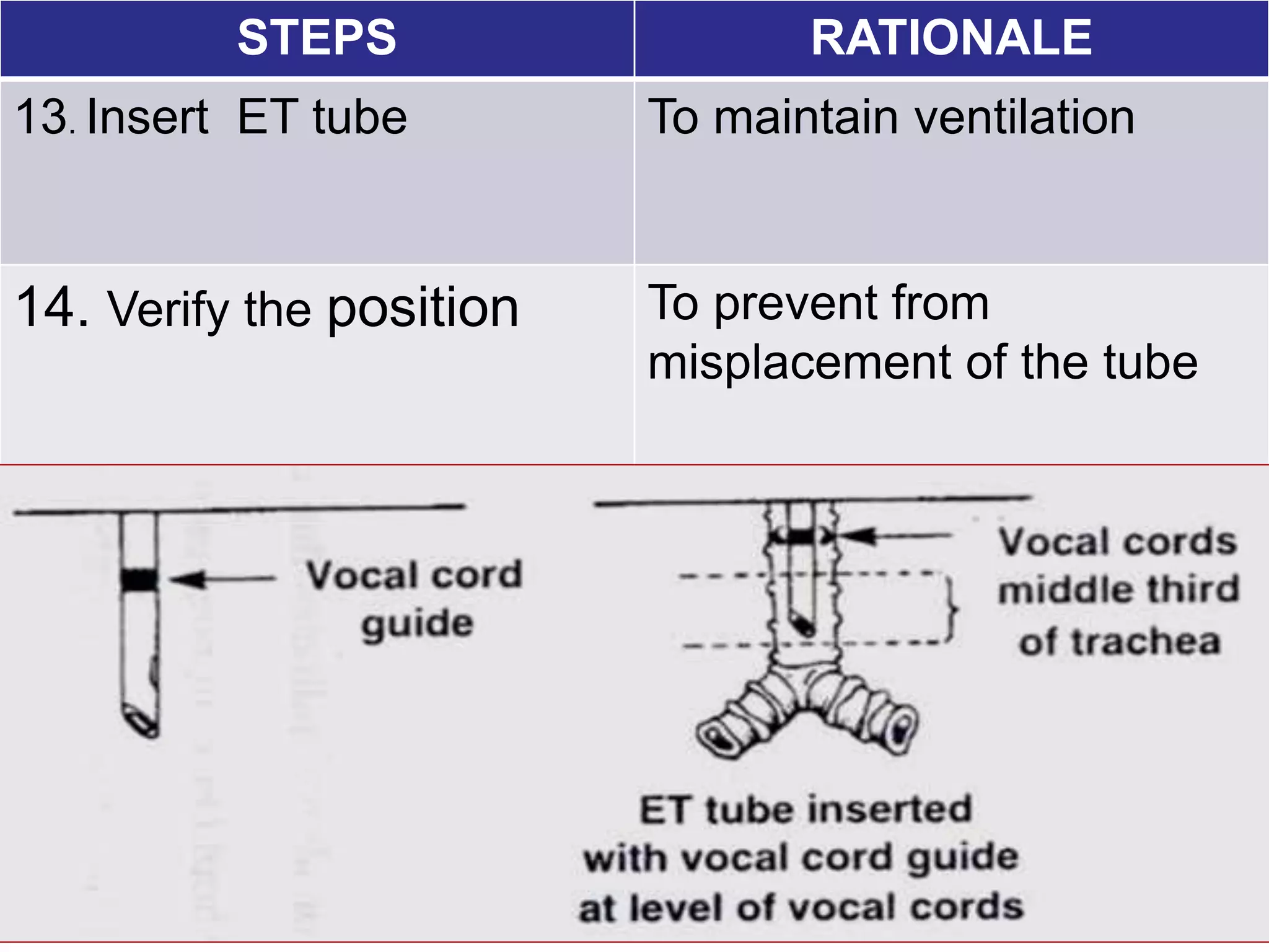 Endotracheal intubation nursing procedure | PPTX
