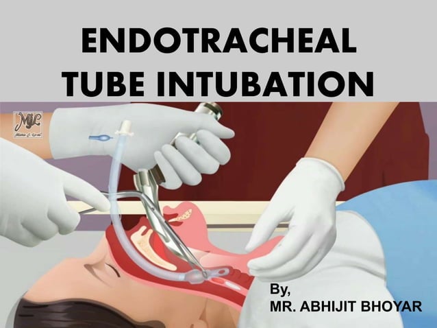 Endotracheal intubation nursing procedure | PPT