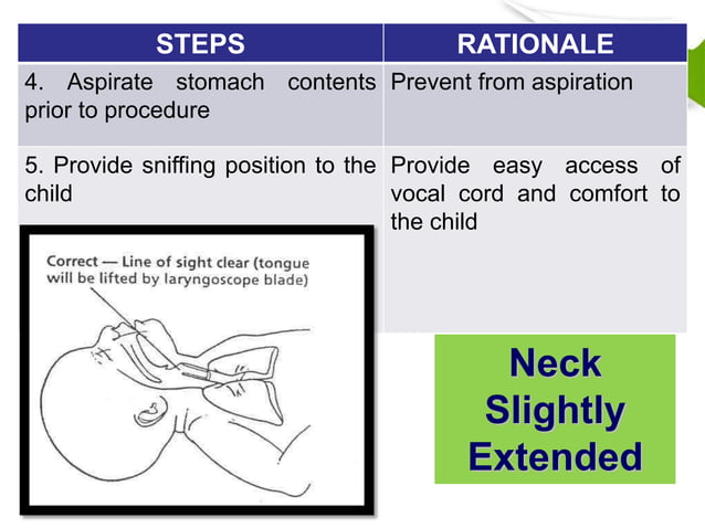 Endotracheal intubation nursing procedure | PPT