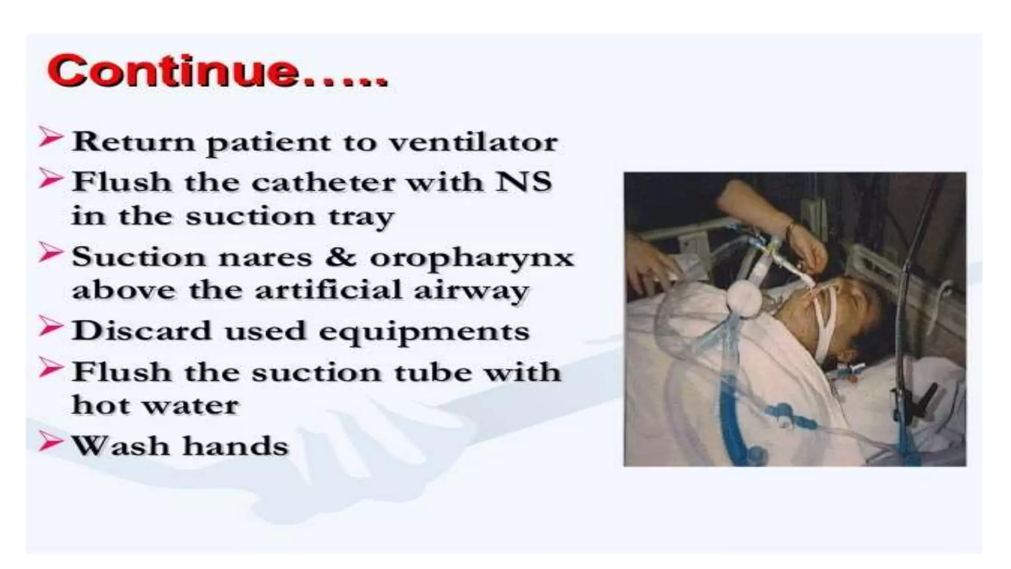 Endotracheal suctioning 2 | PPTX