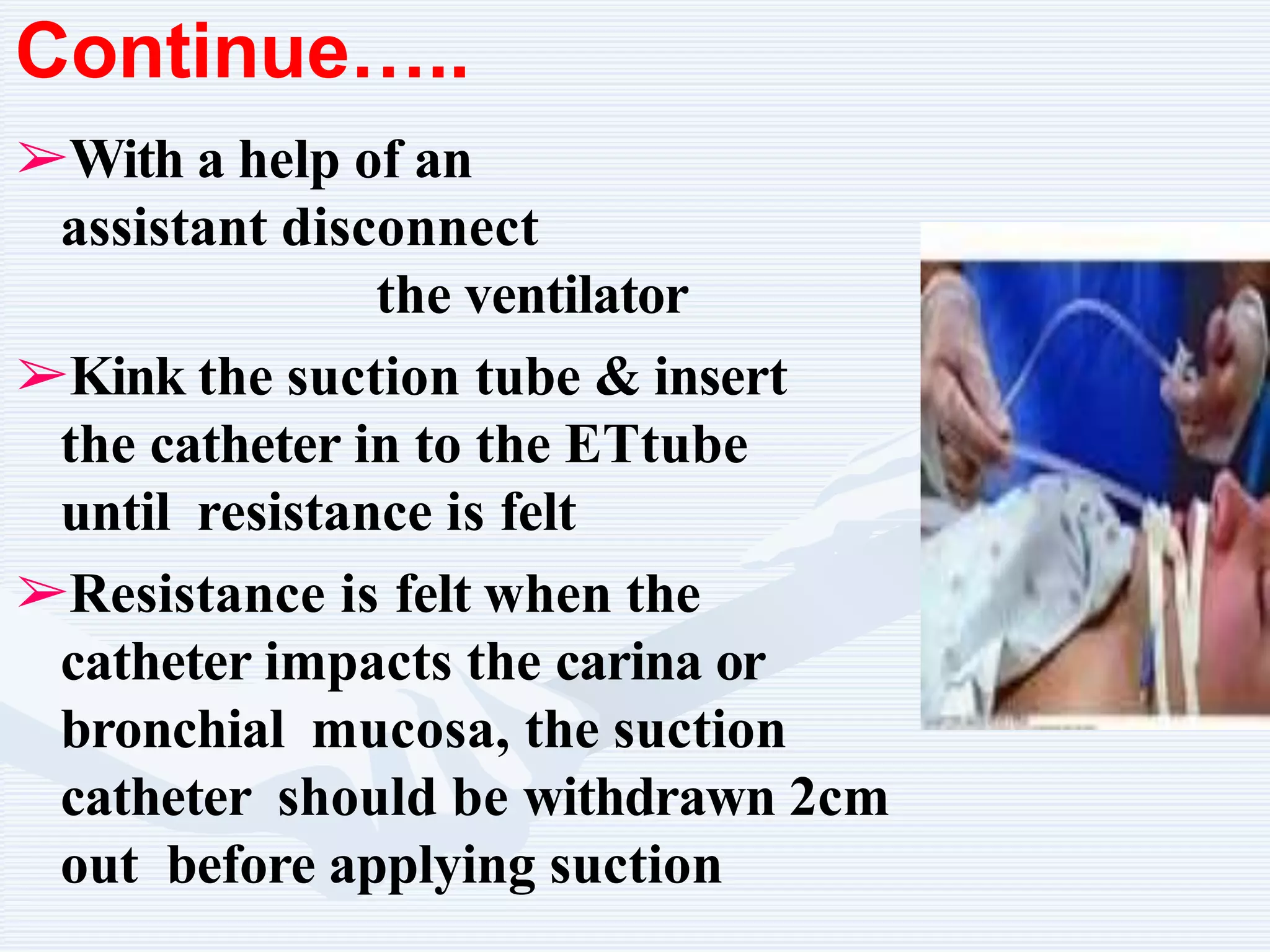 endotracheal suctioning.pptx