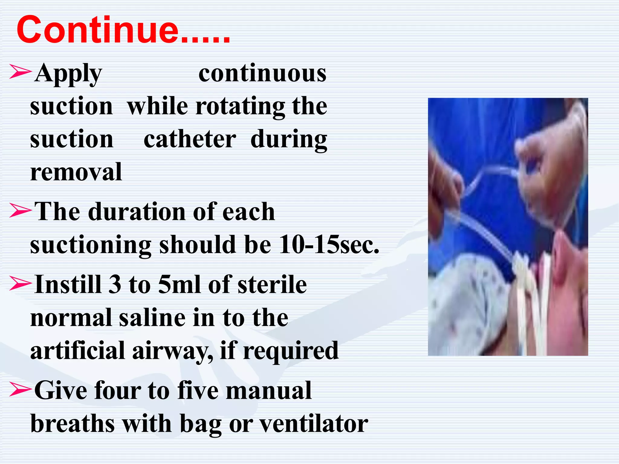 endotracheal suctioning.pptx