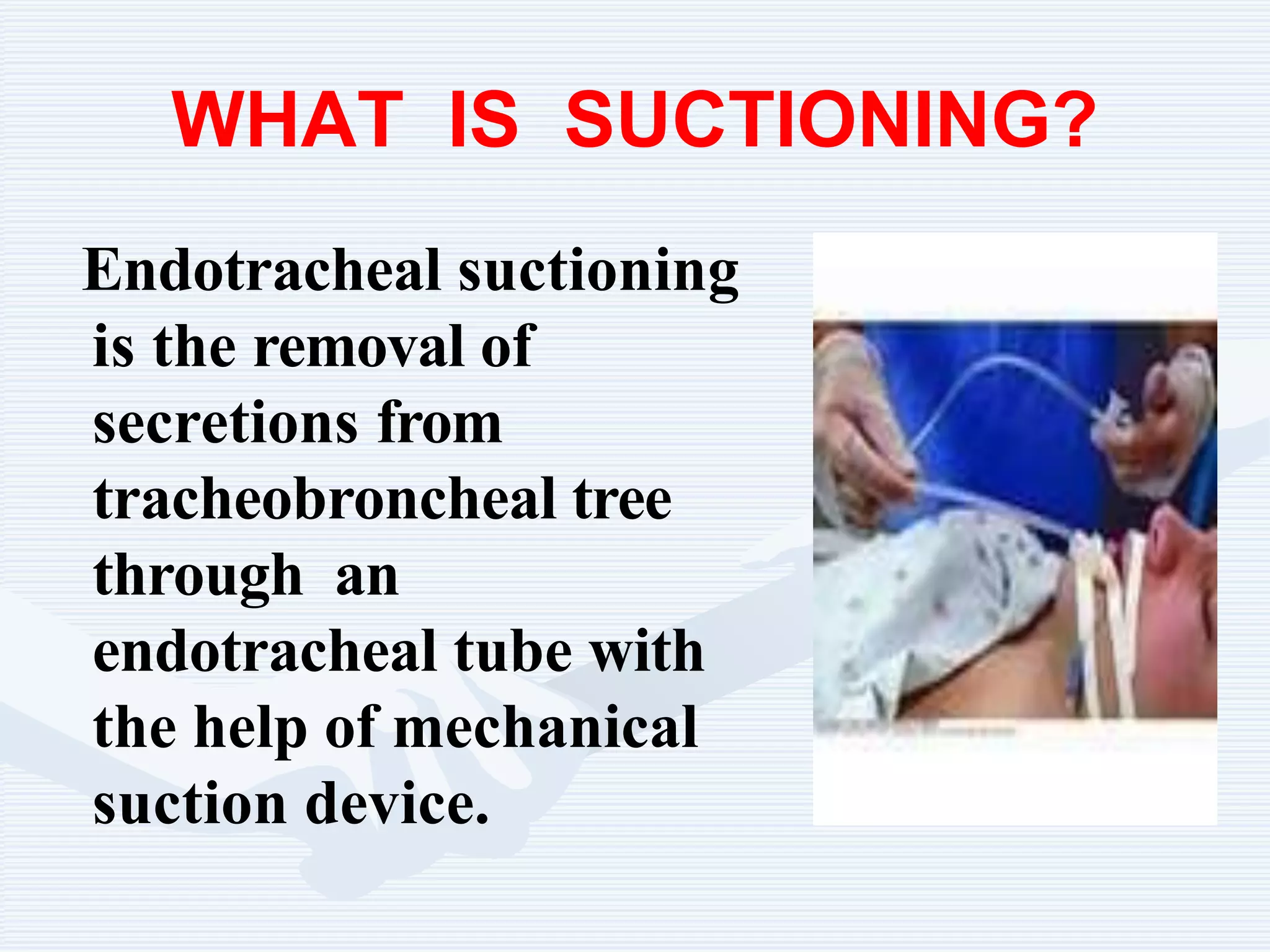 endotracheal suctioning.pptx