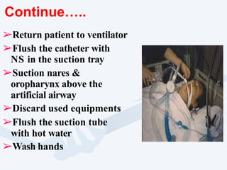 endotracheal suctioning.pptx