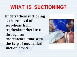 endotracheal suctioning.pptx