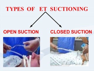 endotracheal suctioning.pptx