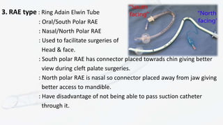 Endotracheal tube | PPT