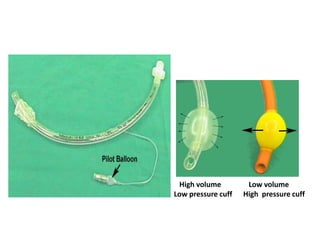 Endotracheal tubes | PPTX