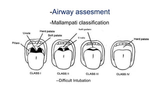 #Endotracheal tubes and intubation | PPT