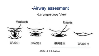 #Endotracheal tubes and intubation | PPT