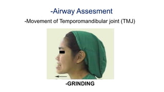 #Endotracheal tubes and intubation | PPTX