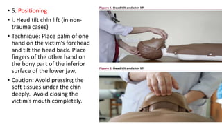 endotrachial intubation.pptx