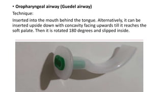 endotrachial intubation.pptx | Lung and Respiratory Health | Diseases ...